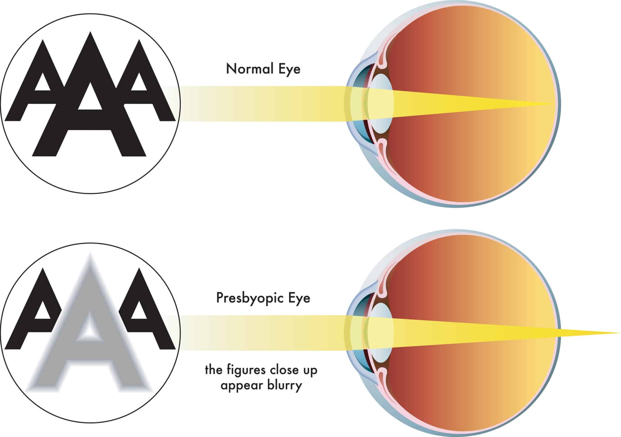 Aging and Your Eyes: How Does Age Impact Vision?