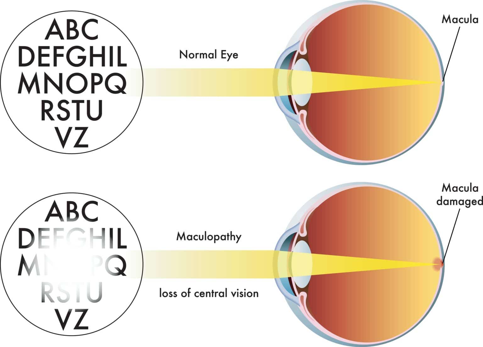 Aging and Your Eyes: How Does Age Impact Vision?